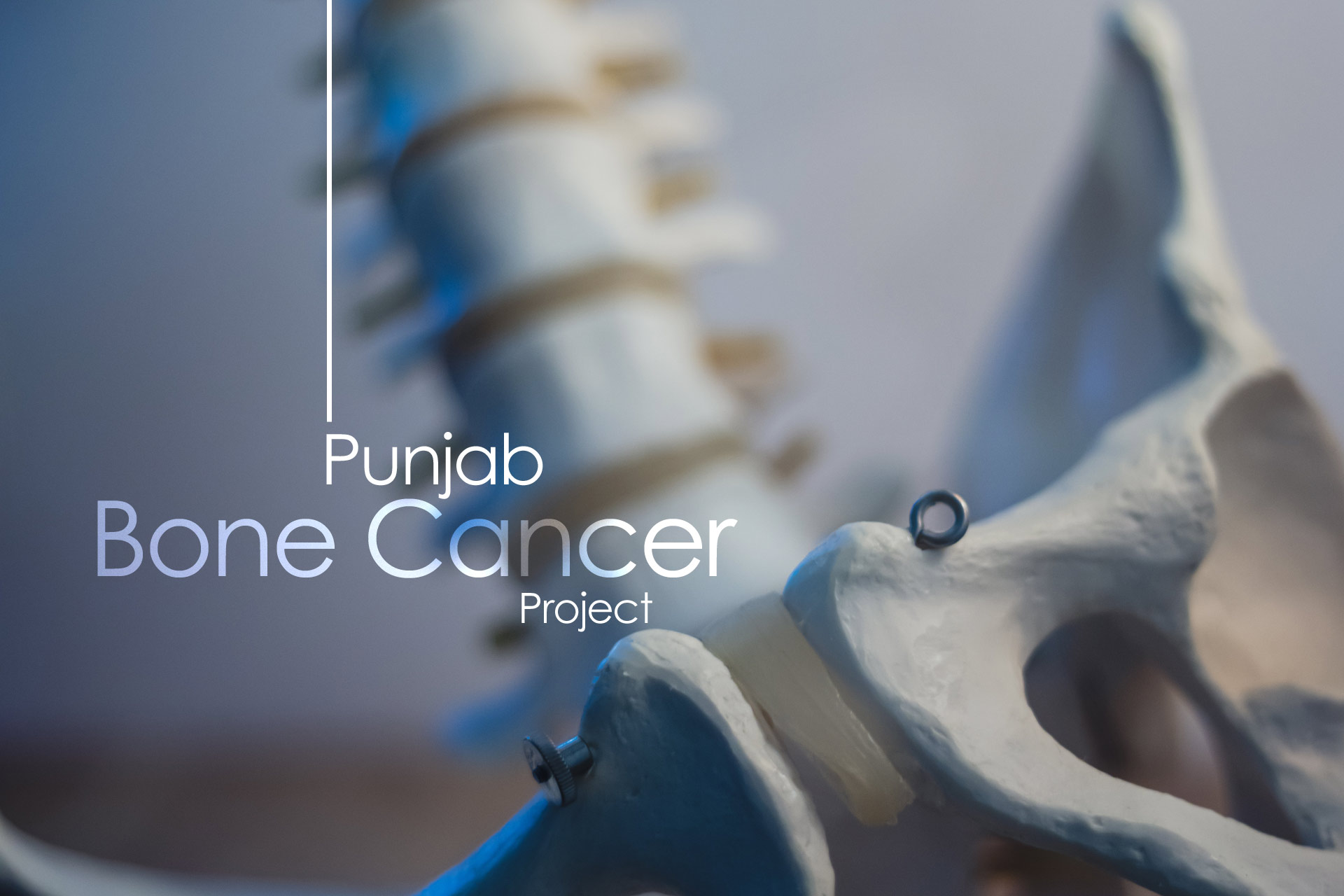 Punjab Bone Cancer Project | MCKS Trust Fund